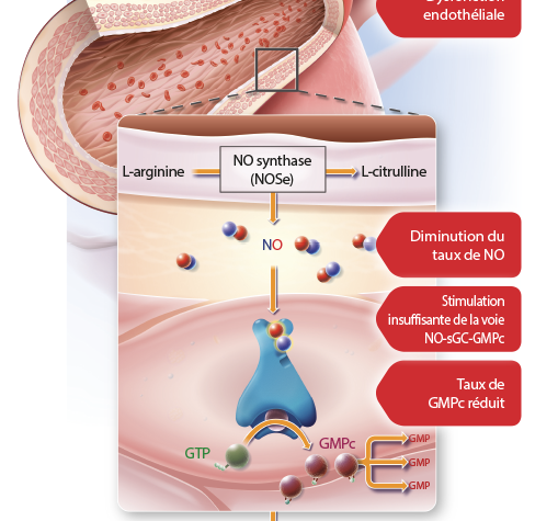 ADEMPAS Archives - MSD Connect, Le site des professionnels de santé